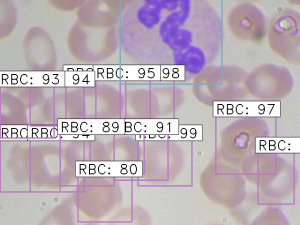 Faster RCNN Python | Faster R-CNN For Object Detection