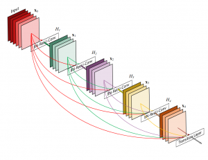 What are Skip Connections in Deep Learning?