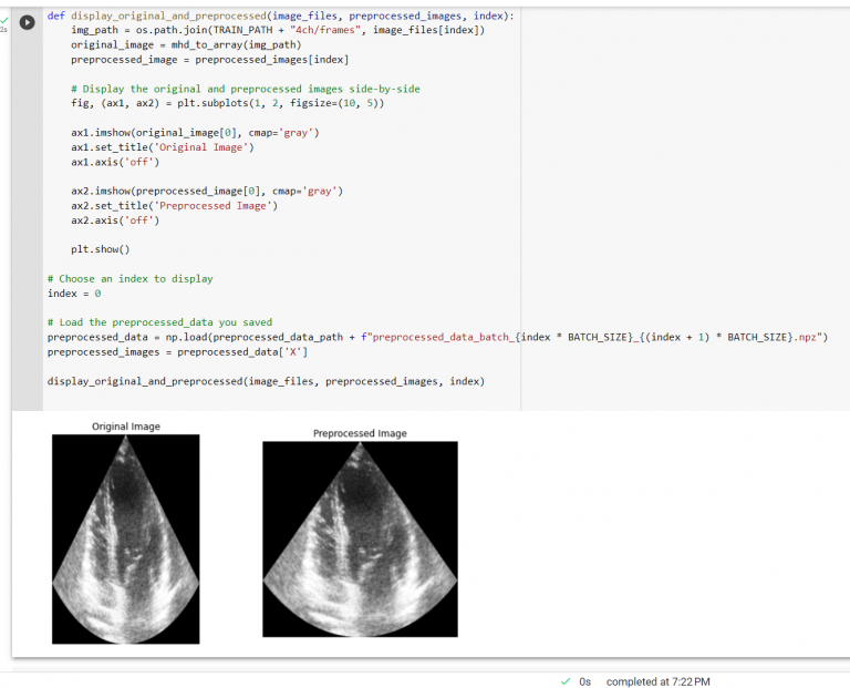 Preprocessing the Image Dataset for Left Ventricle Segmentation