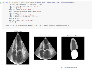 Preprocessing the Image Dataset for Left Ventricle Segmentation