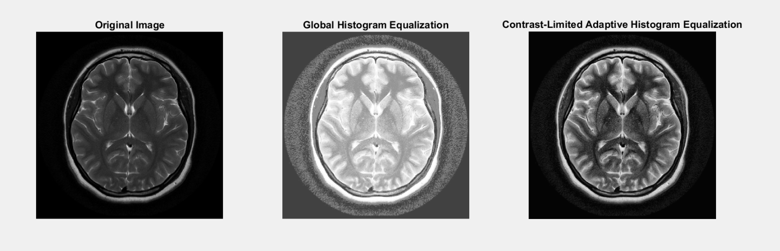 Quick Guide to Histogram Equalization for Clearer Images