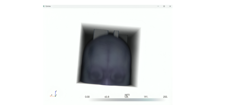 How to Use PyVista for Interactive 3D Medical Visualizations